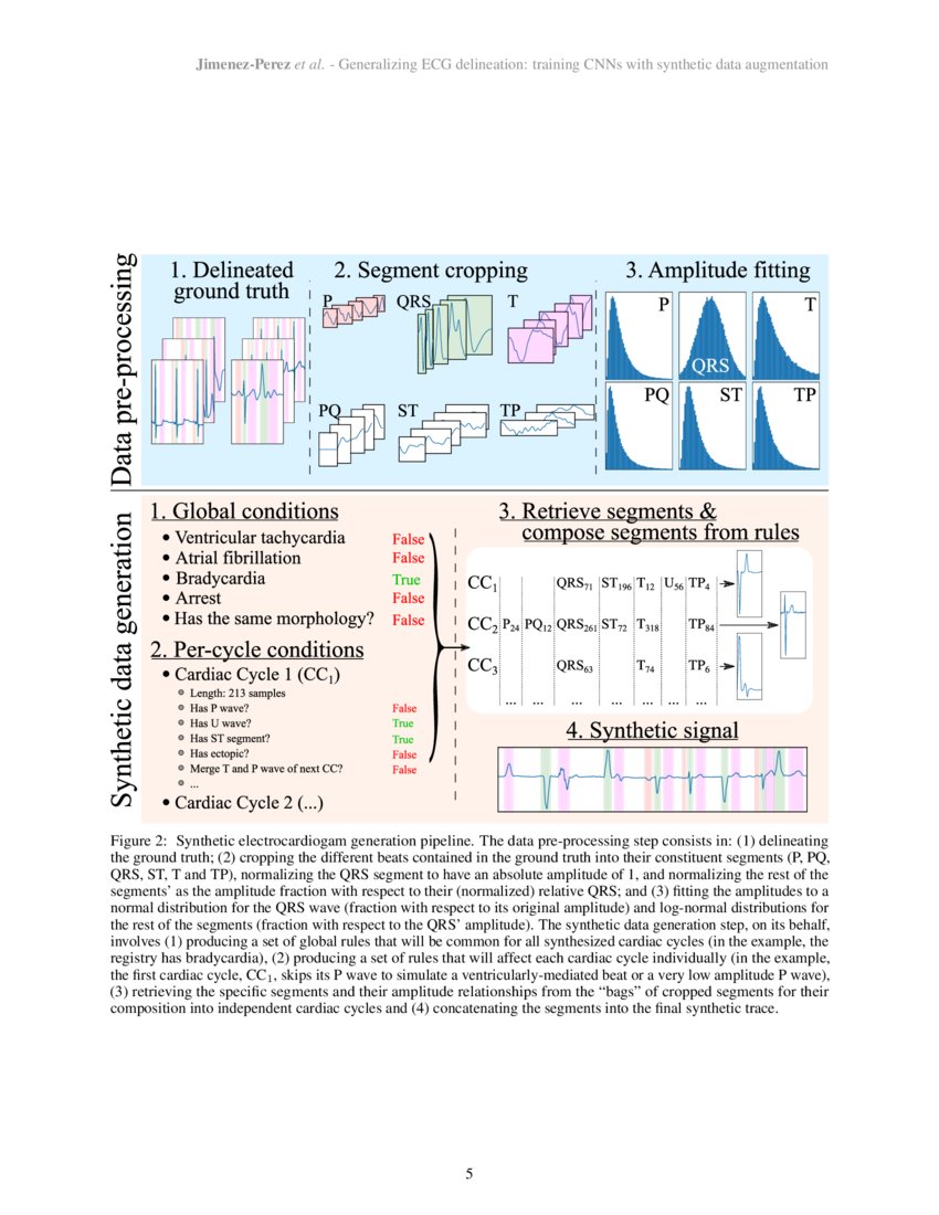 Generalizing Electrocardiogram Delineation Training Convolutional