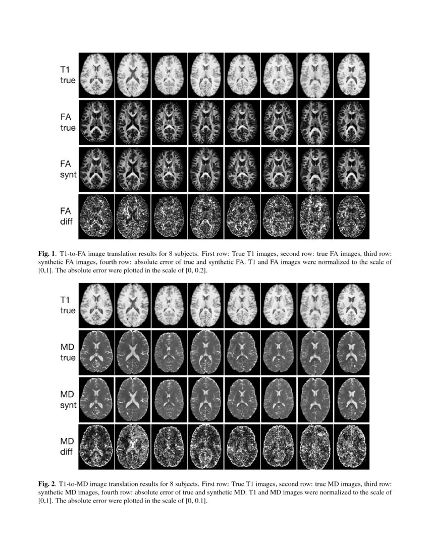 Generating Diffusion MRI scalar maps from T1 weighted images using ...