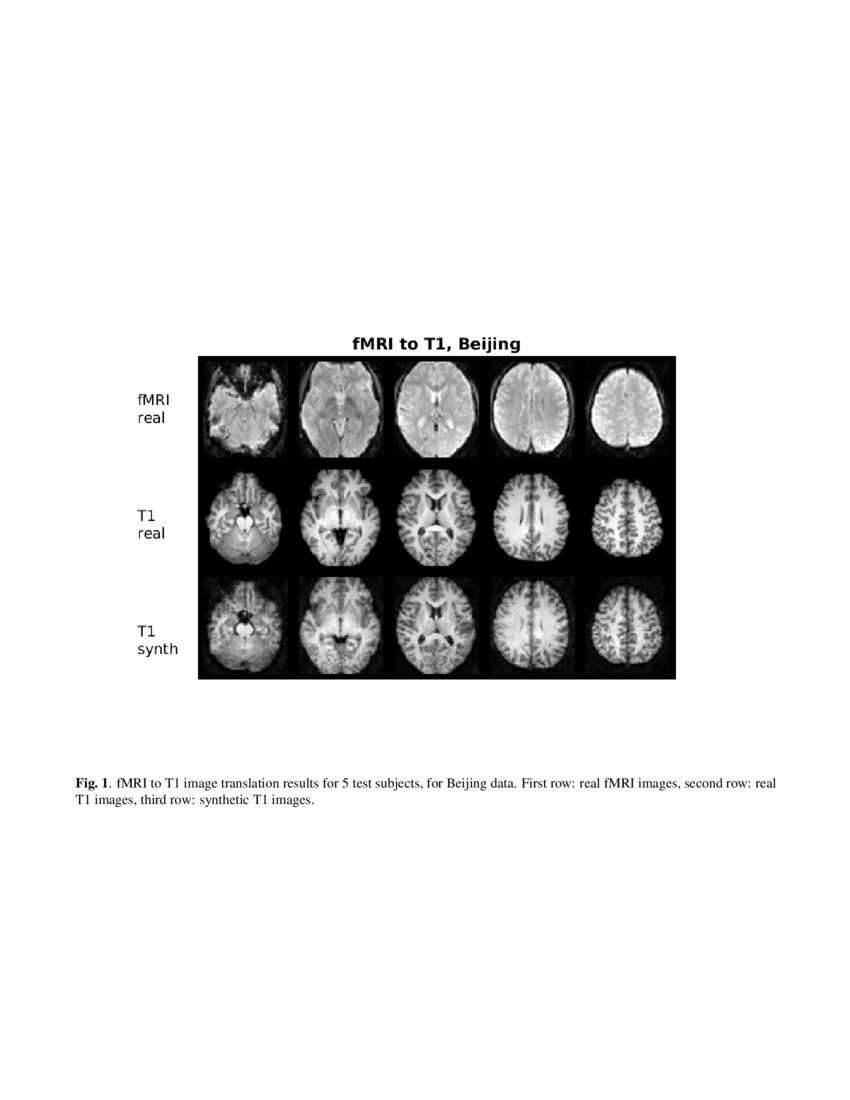 Generating Fmri Volumes From T1 Weighted Volumes Using 3d Cyclegan Deepai