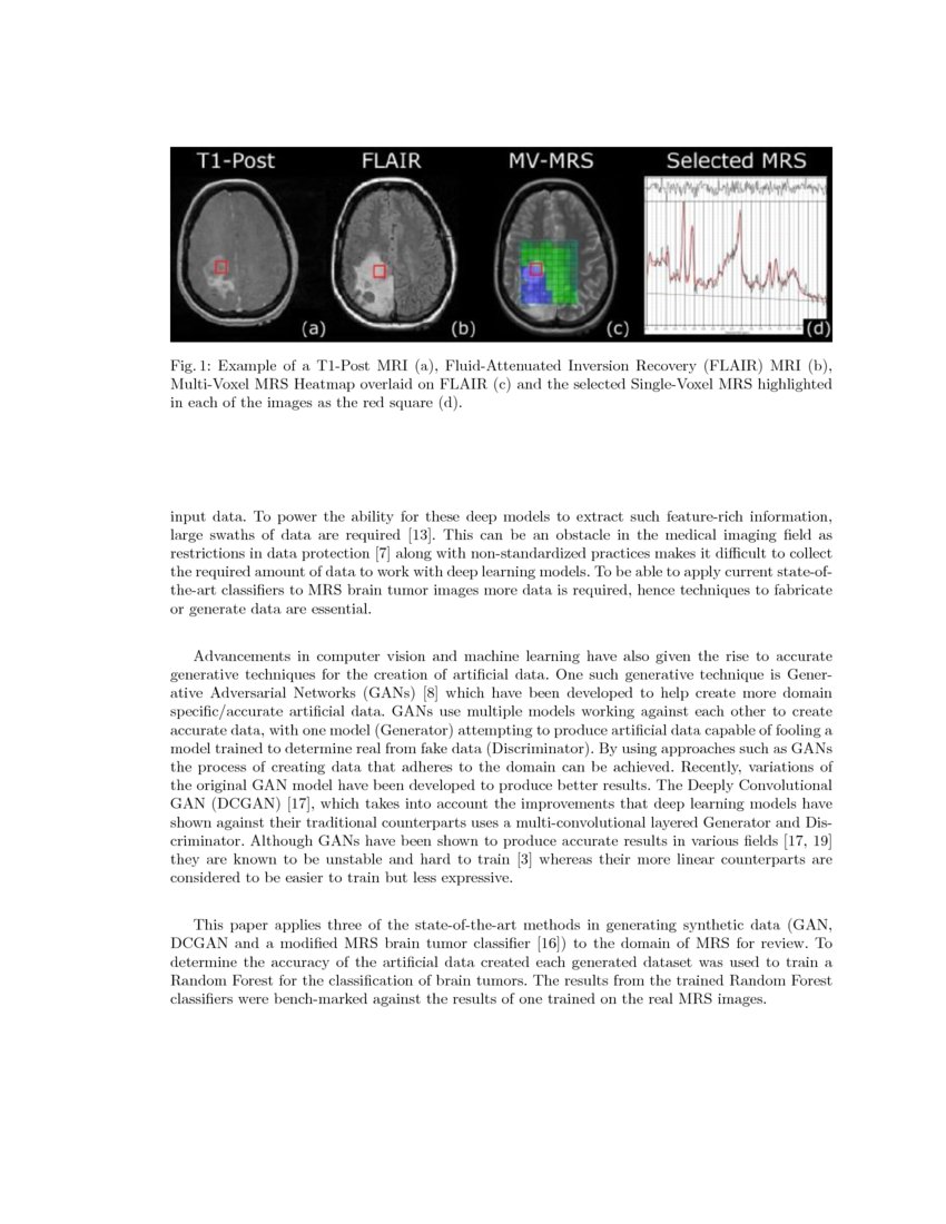 Generating Magnetic Resonance Spectroscopy Imaging Data of Brain ...