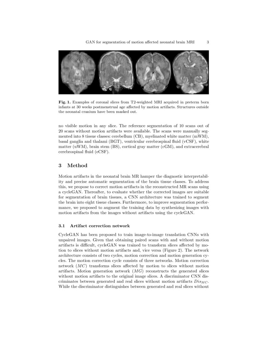 Generative adversarial network for segmentation of motion affected ...