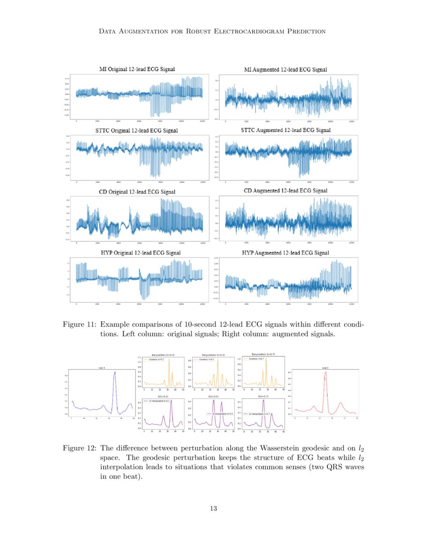 GeoECG: Data Augmentation via Wasserstein Geodesic Perturbation for Robust Electrocardiogram ...
