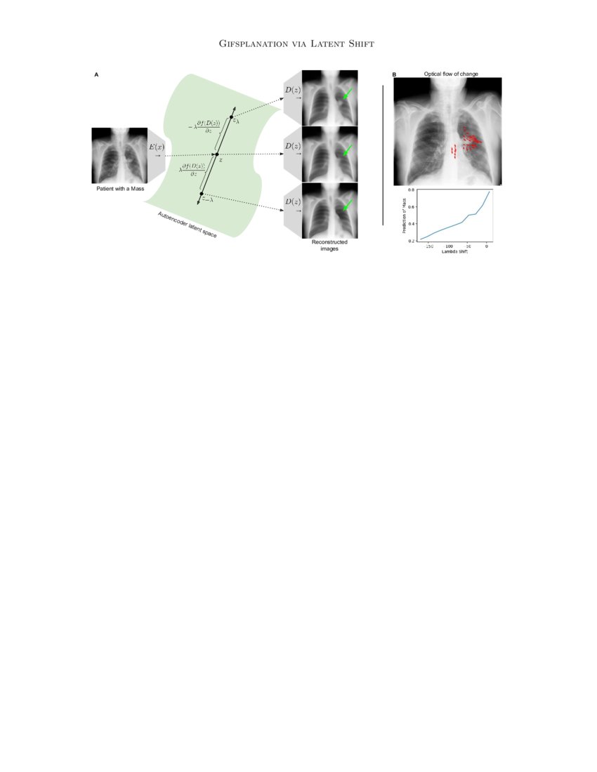Gifsplanation via Latent Shift: A Simple Autoencoder Approach to Progressive Exaggeration on ...