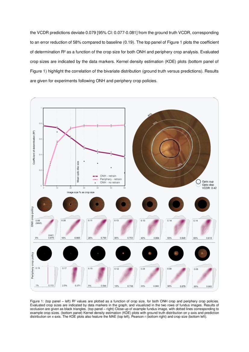 Glaucoma detection beyond the optic disc: The importance of the peripapillary region using ...