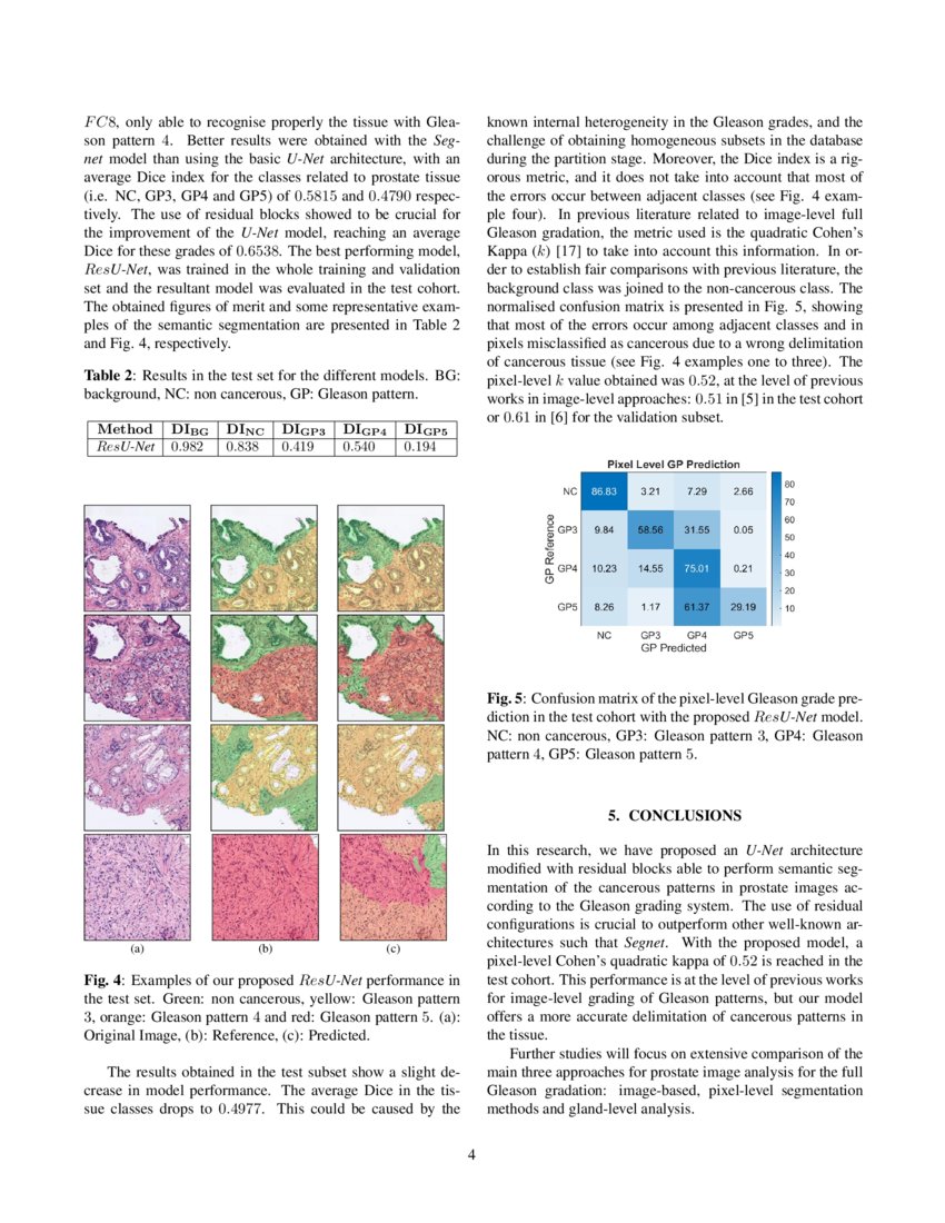 Gleason Grading Of Histology Prostate Images Through Semantic Segmentation Via Residual U Net