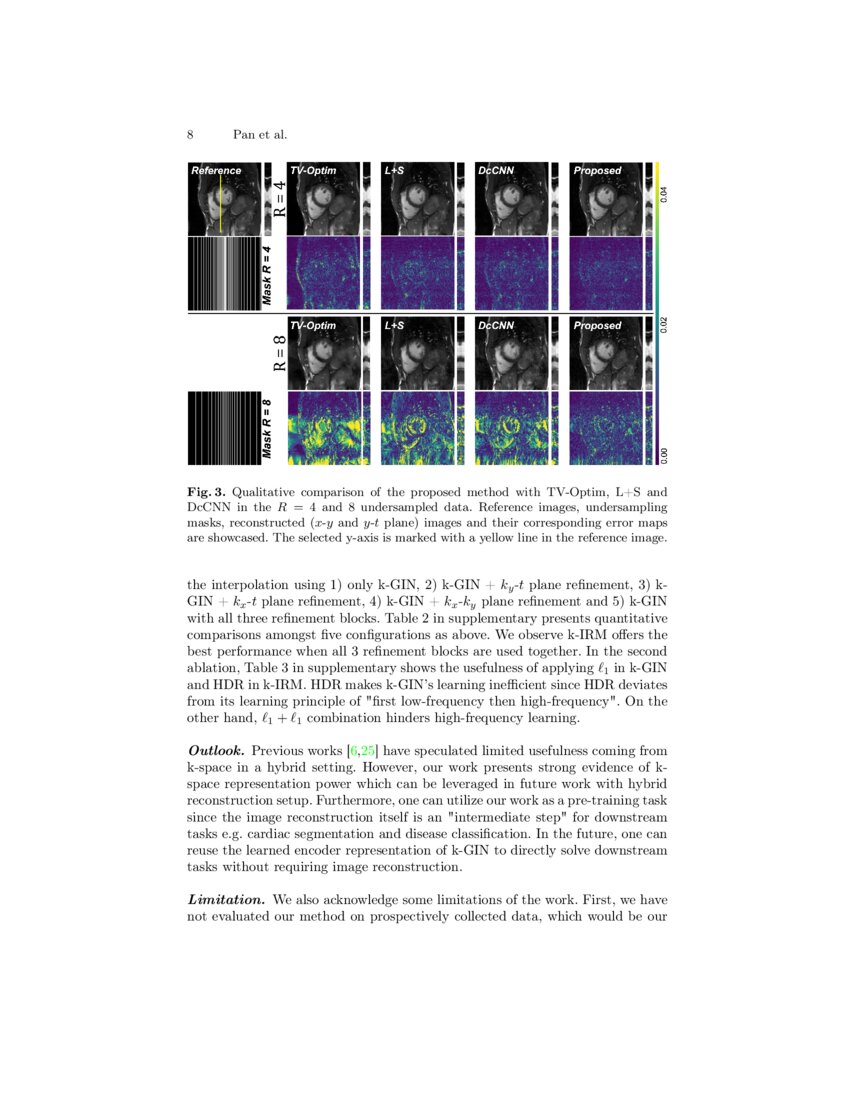 Global K Space Interpolation For Dynamic Mri Reconstruction Using Masked Image Modeling Deepai