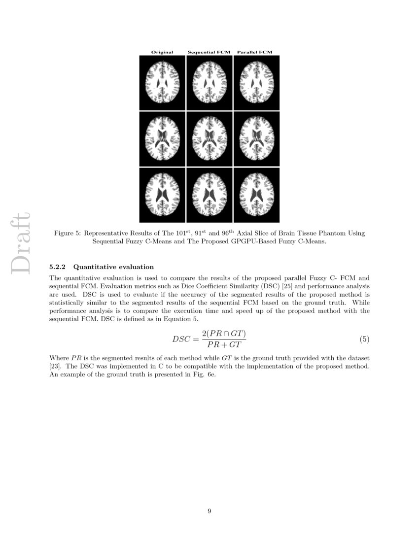 GPU Based Fuzzy C Means Clustering Algorithm For Image Segmentation