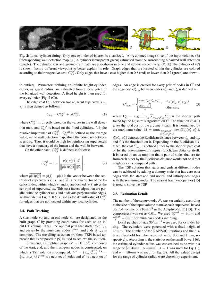 Graph-Based Small Bowel Path Tracking with Cylindrical Constraints | DeepAI