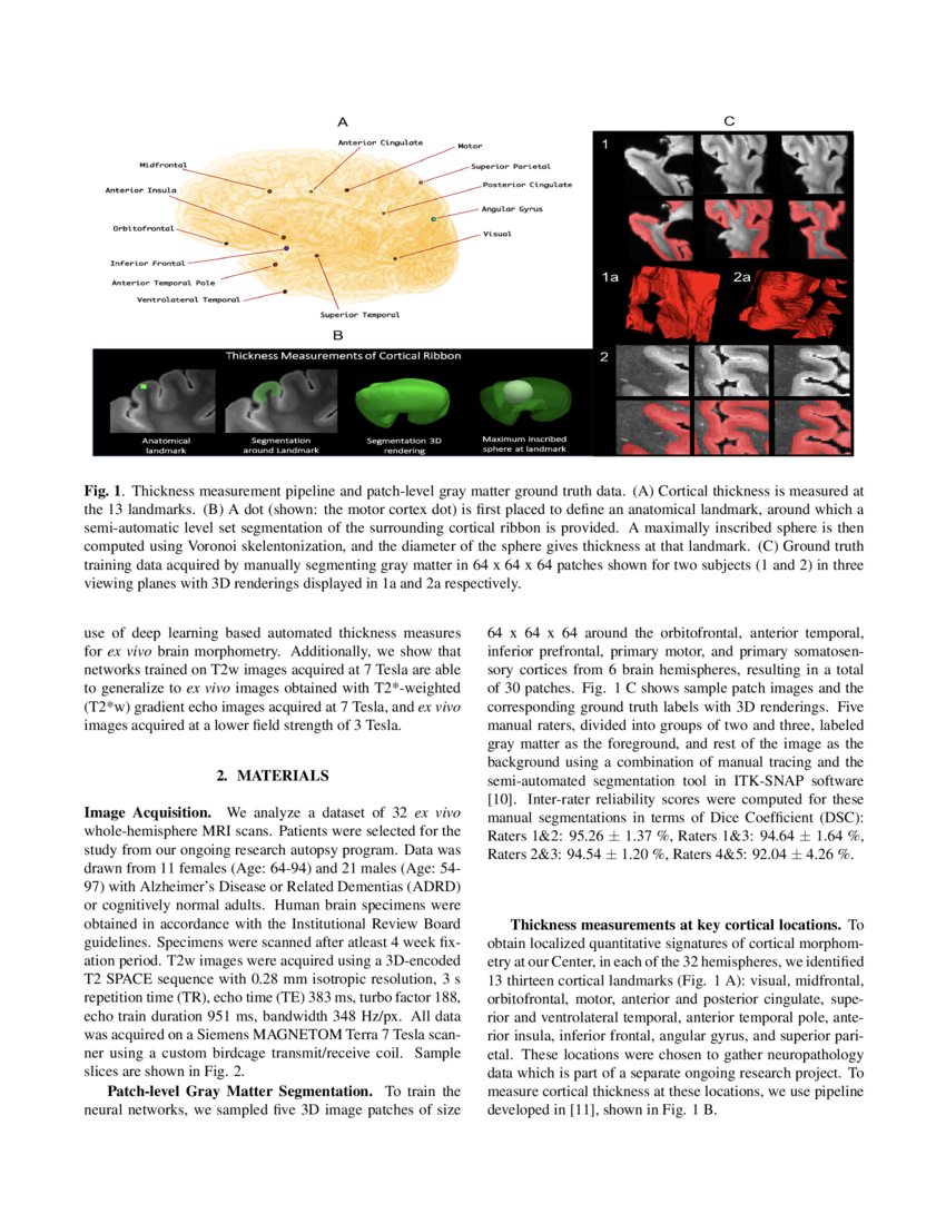 Gray Matter Segmentation in Ultra High Resolution 7 Tesla ex vivo T2w ...