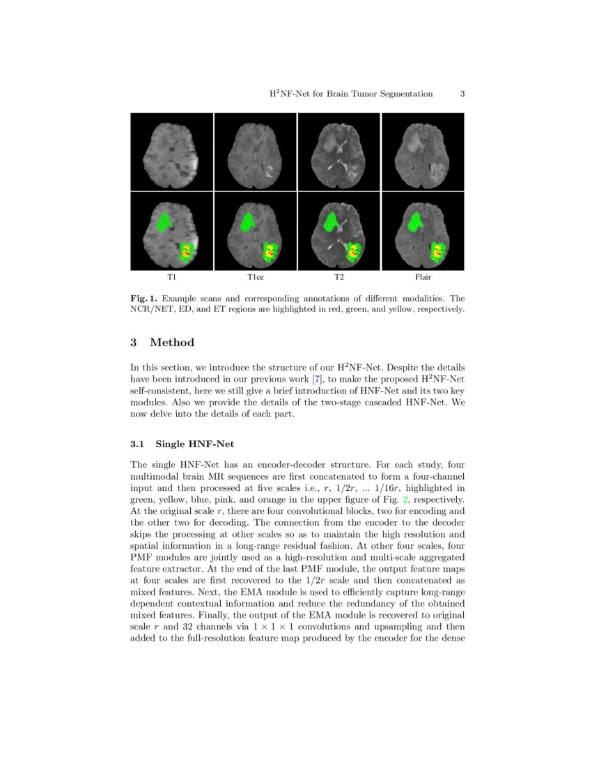 H2nf Net For Brain Tumor Segmentation Using Multimodal Mr Imaging 2nd