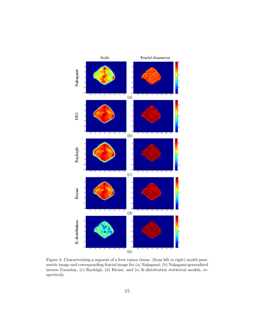 Heterogeneous tissue characterization using ultrasound: a comparison of ...
