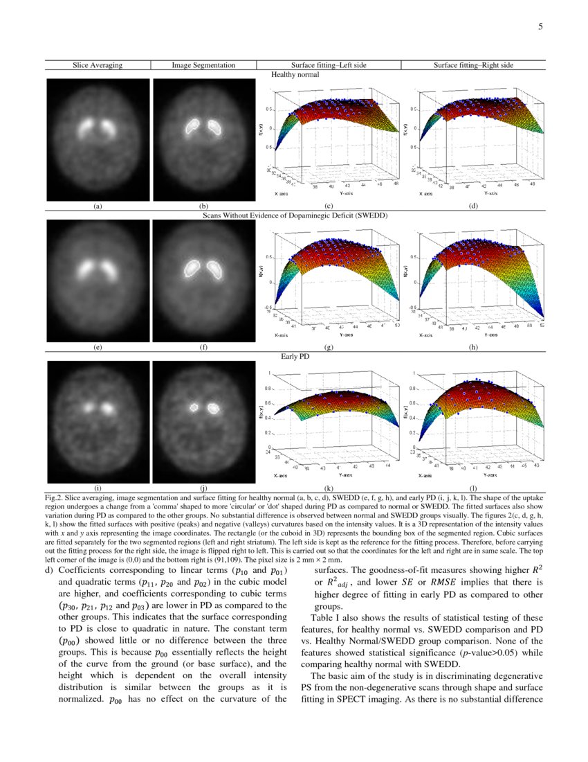 High Accuracy Classification of Parkinson's Disease through Shape ...