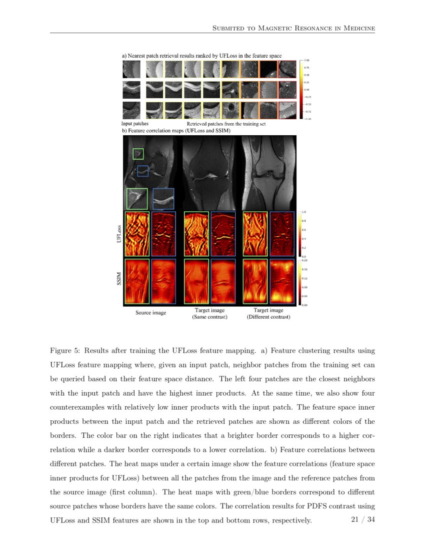 High Fidelity Deep Learning-based MRI Reconstruction with Instance-wise ...