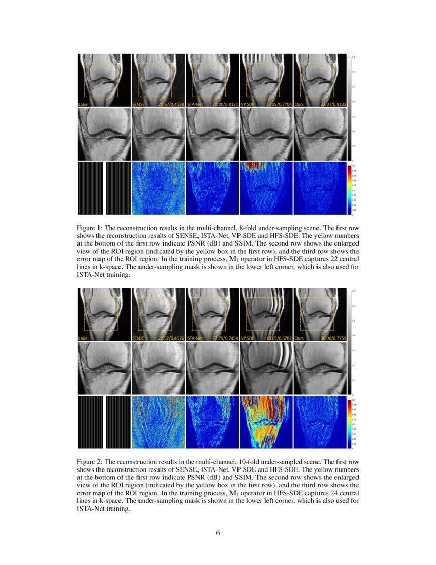 High-Frequency Space Diffusion Models for Accelerated MRI | DeepAI