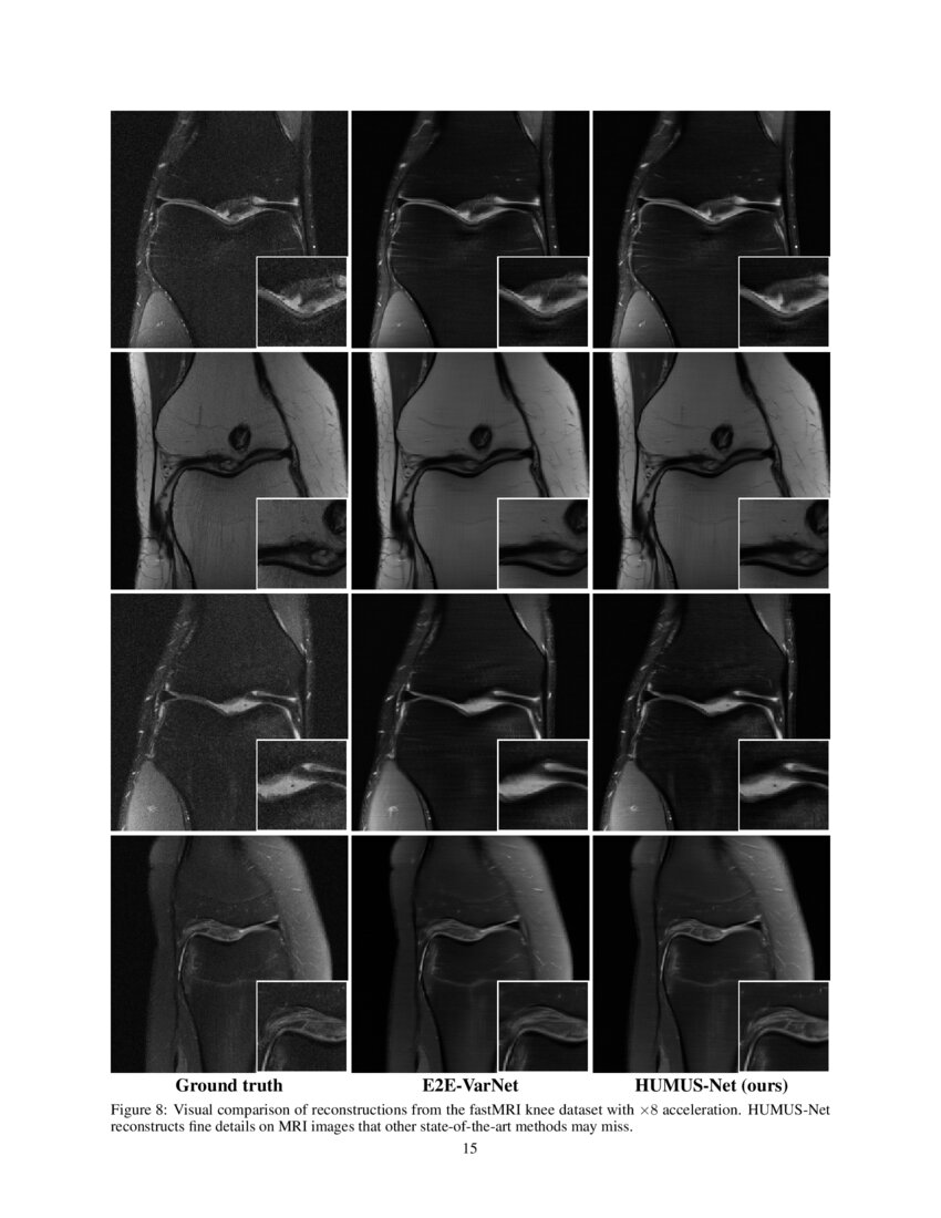 HUMUS-Net: Hybrid unrolled multi-scale network architecture for ...