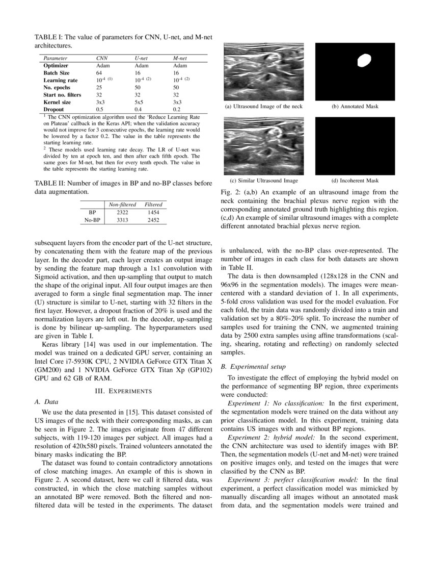 Hybrid Deep Neural Network for Brachial Plexus Nerve Segmentation in Ultrasound Images | DeepAI