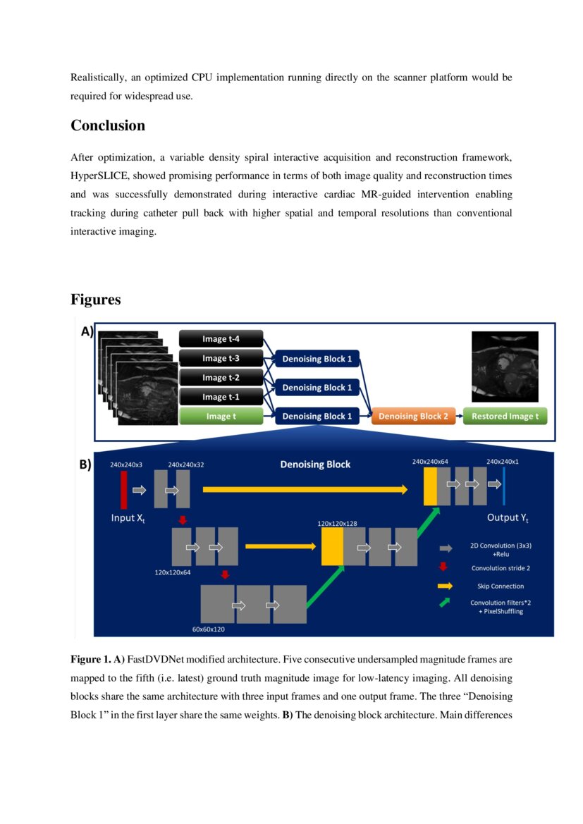 HyperSLICE: HyperBand optimised Spiral for Low-latency Interactive ...