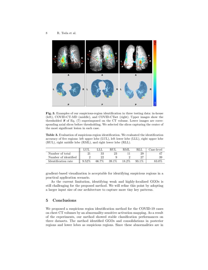 Identifying Suspicious Regions of Covid-19 by Abnormality-Sensitive ...