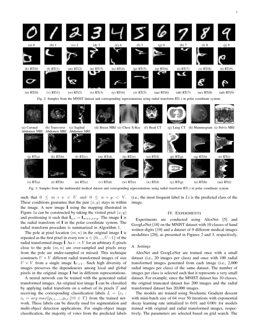 Image Augmentation using Radial Transform for Training Deep Neural ...