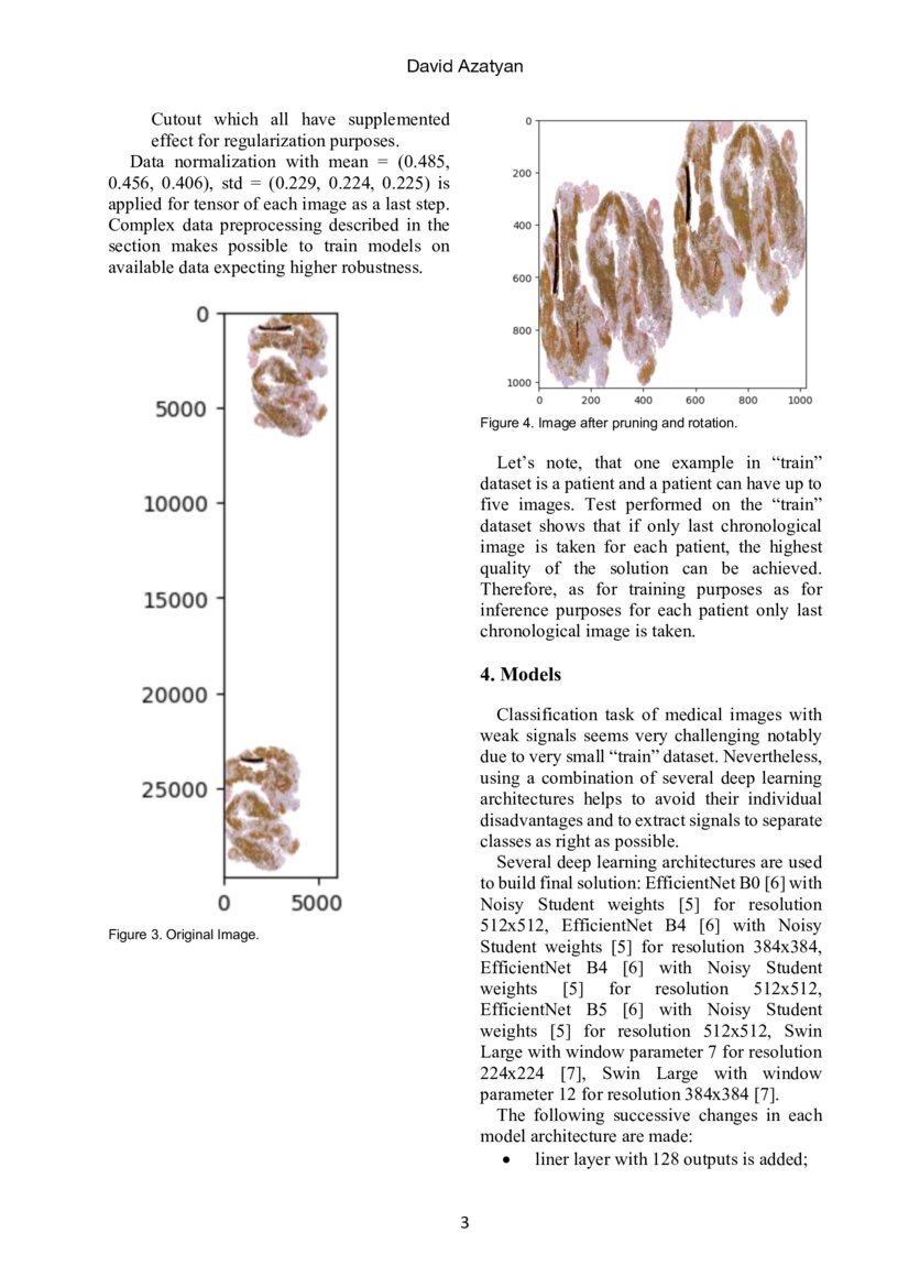 Image Classification of Stroke Blood Clot Origin using Deep Convolutional Neural Networks and ...