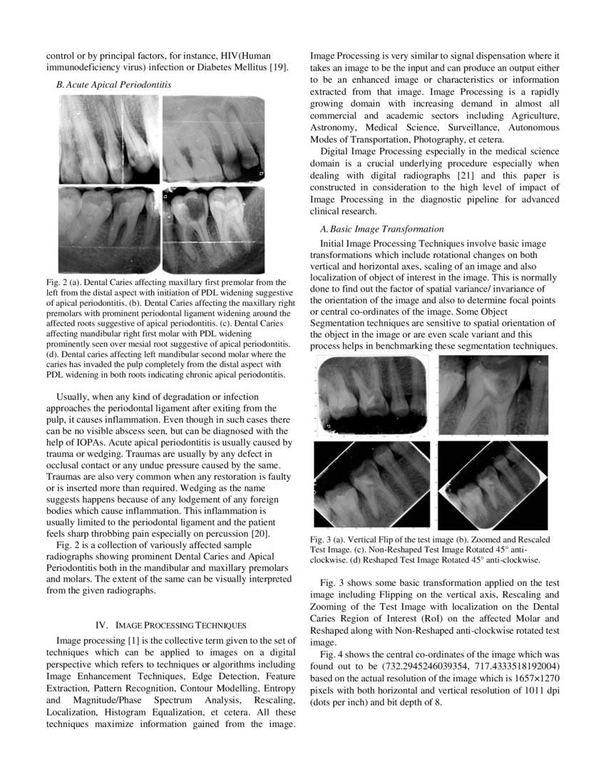 Image Processing on IOPA Radiographs: A comprehensive case study on ...