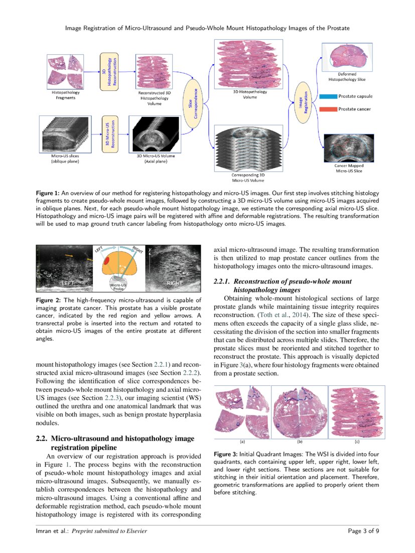 Image Registration of In Vivo Micro-Ultrasound and Ex Vivo Pseudo-Whole ...