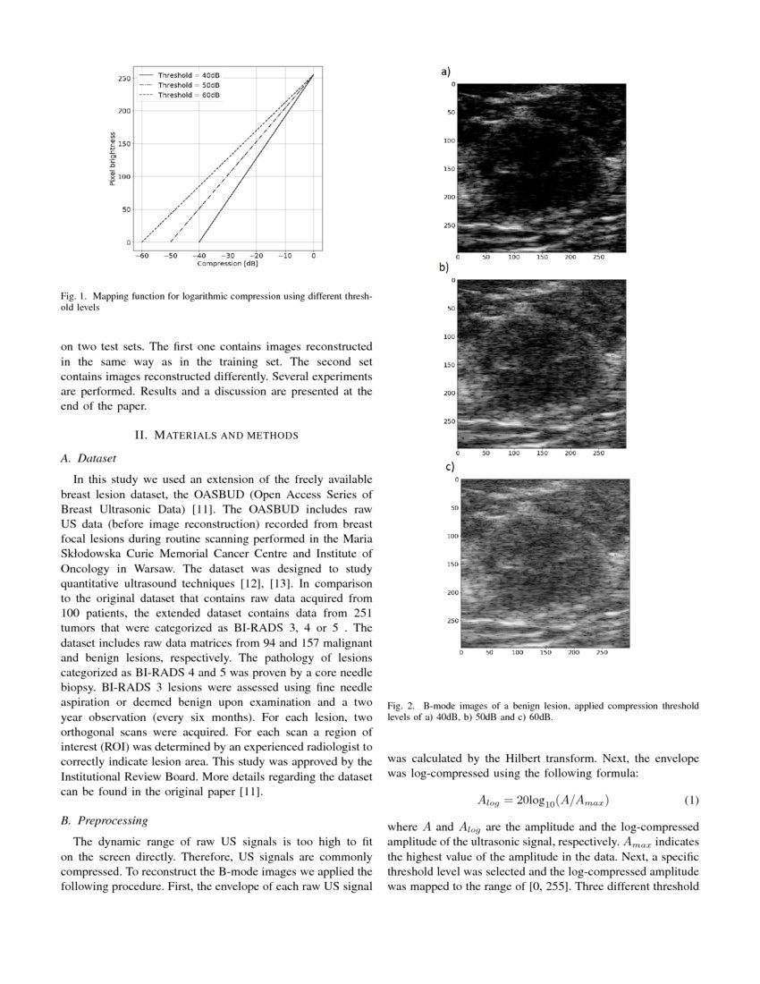 Impact of ultrasound image reconstruction method on breast lesion classification with neural ...
