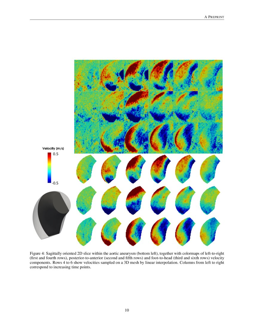 Implicit Neural Representations For Unsupervised Super Resolution And Denoising Of 4d Flow Mri