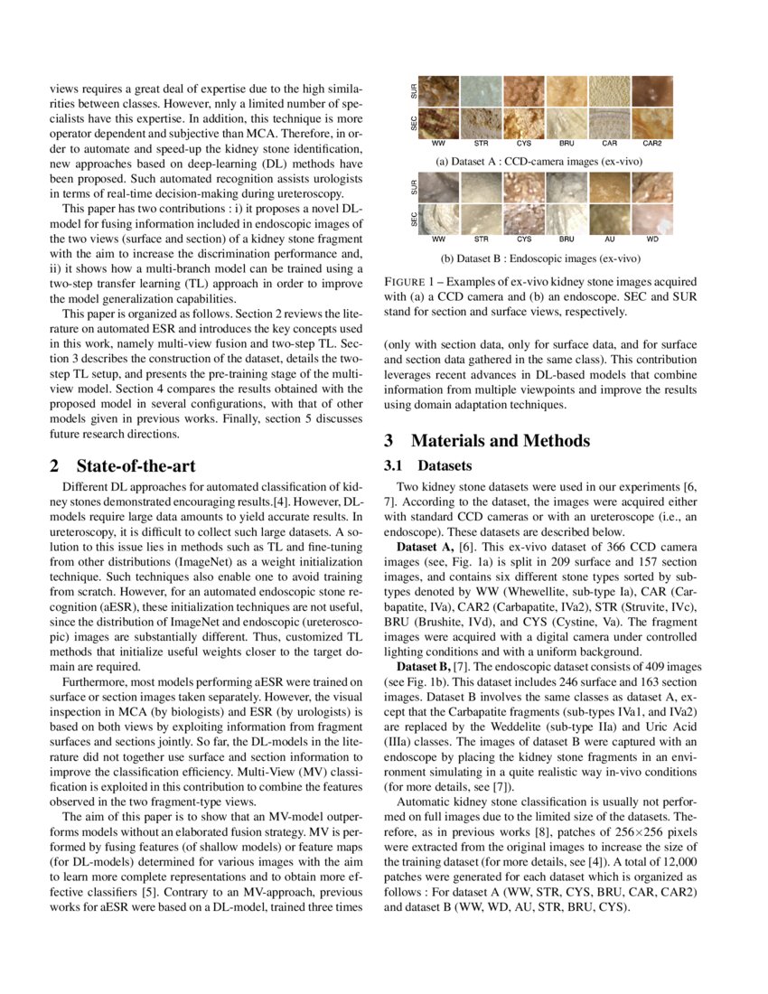 Improving automatic endoscopic stone recognition using a multi-view ...