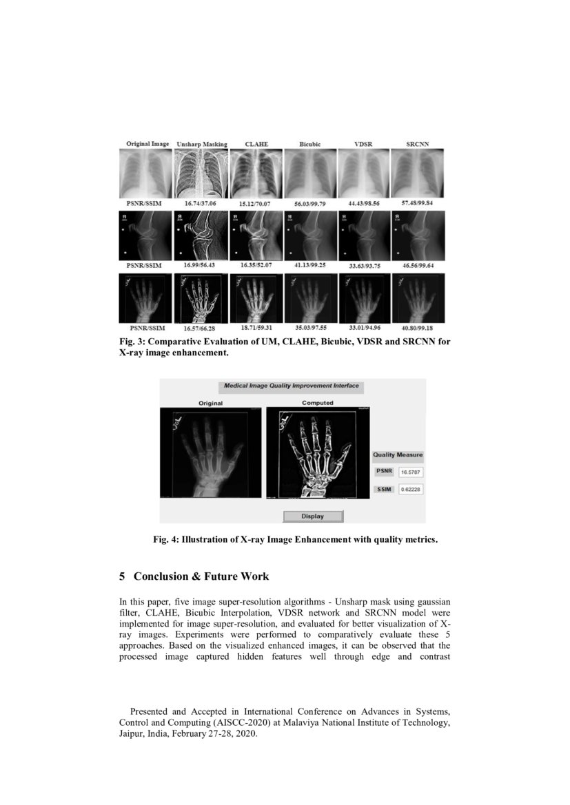 Improving Clinical Diagnosis Performance With Automated X Ray Scan 0700