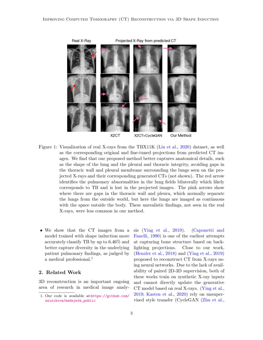 Improving Computed Tomography (CT) Reconstruction via 3D Shape Induction | DeepAI
