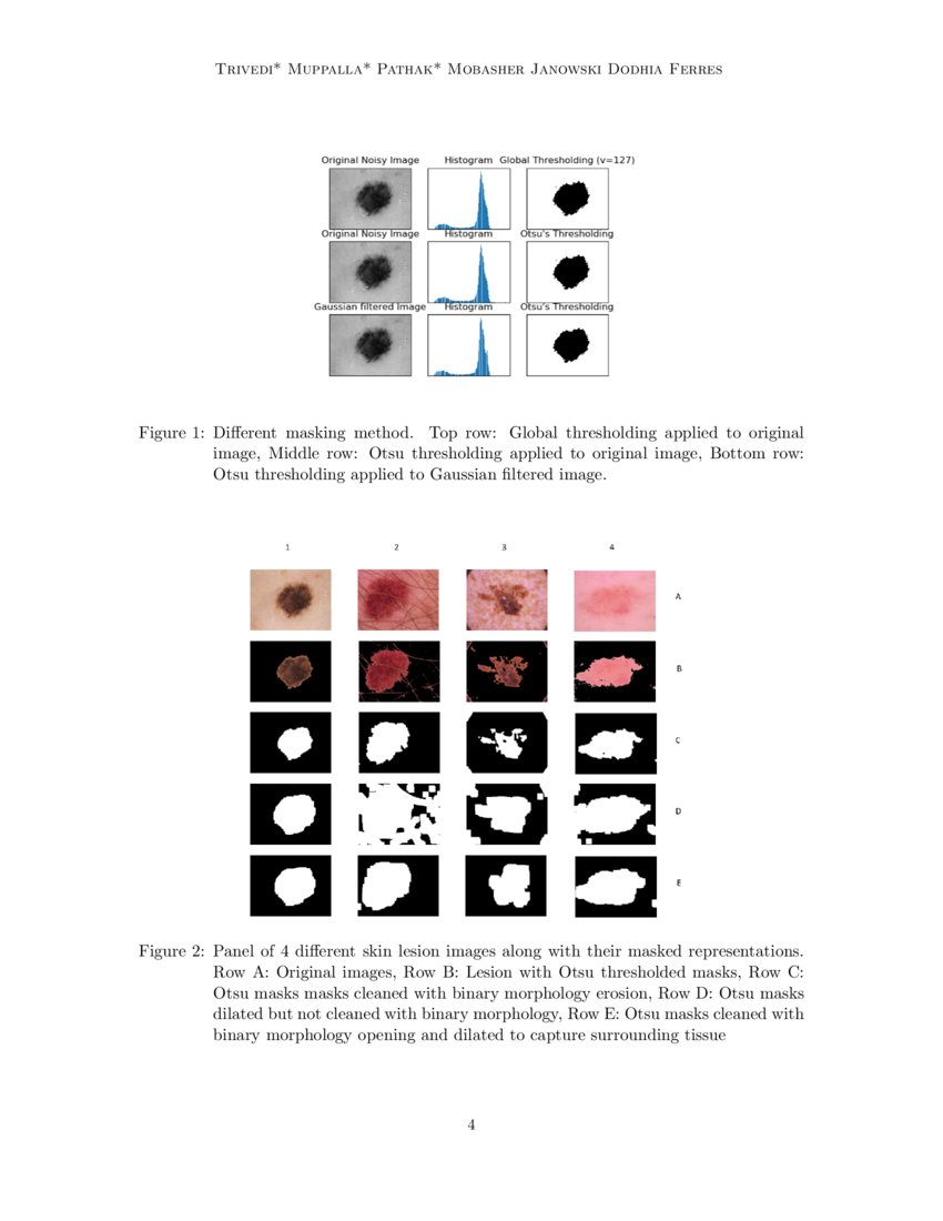 Improving Lesion Detection By Exploring Bias On Skin Lesion Dataset