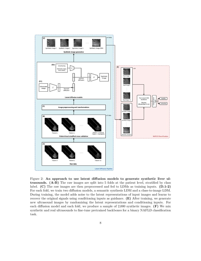 Improving Nonalcoholic Fatty Liver Disease Classification Performance