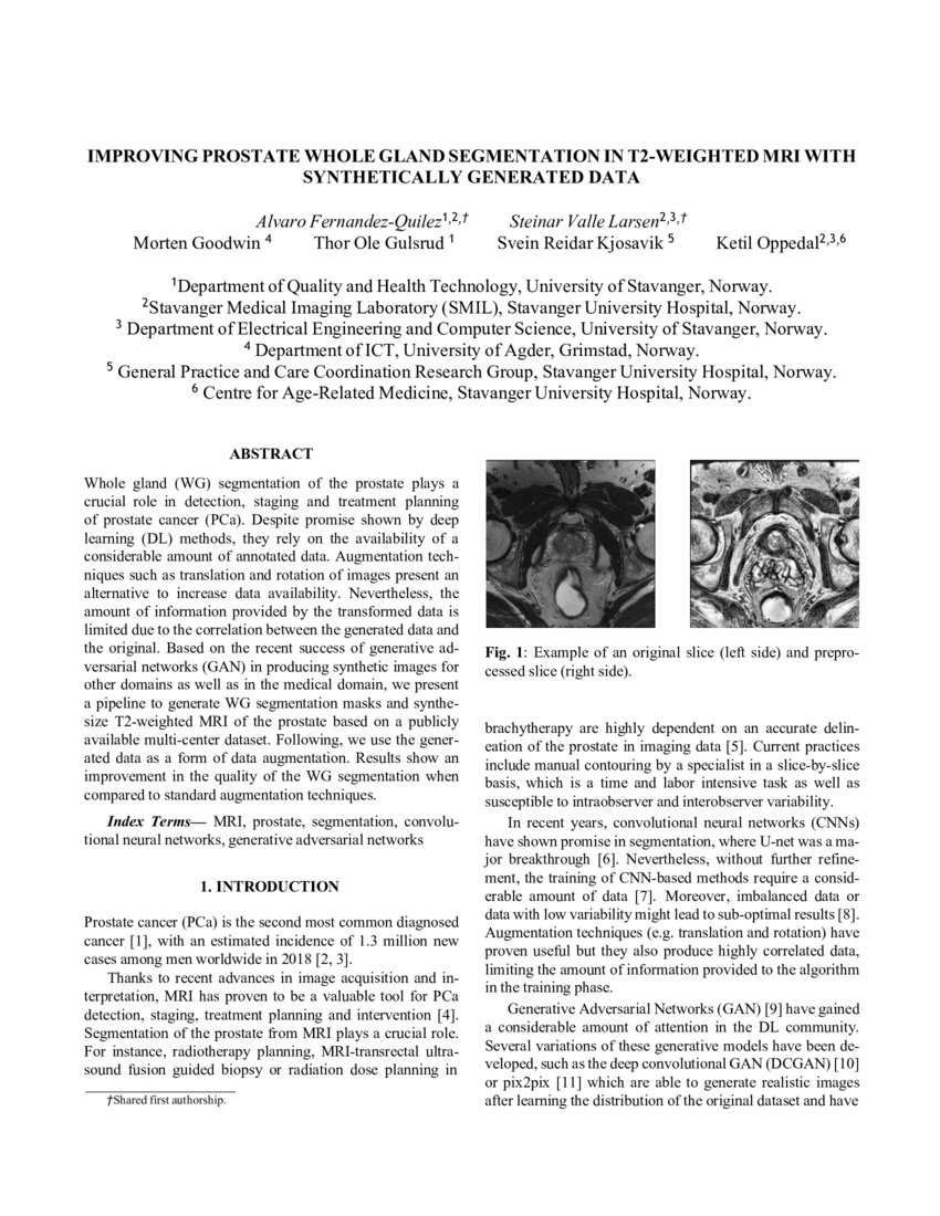 Improving Prostate Whole Gland Segmentation In T2 Weighted Mri With