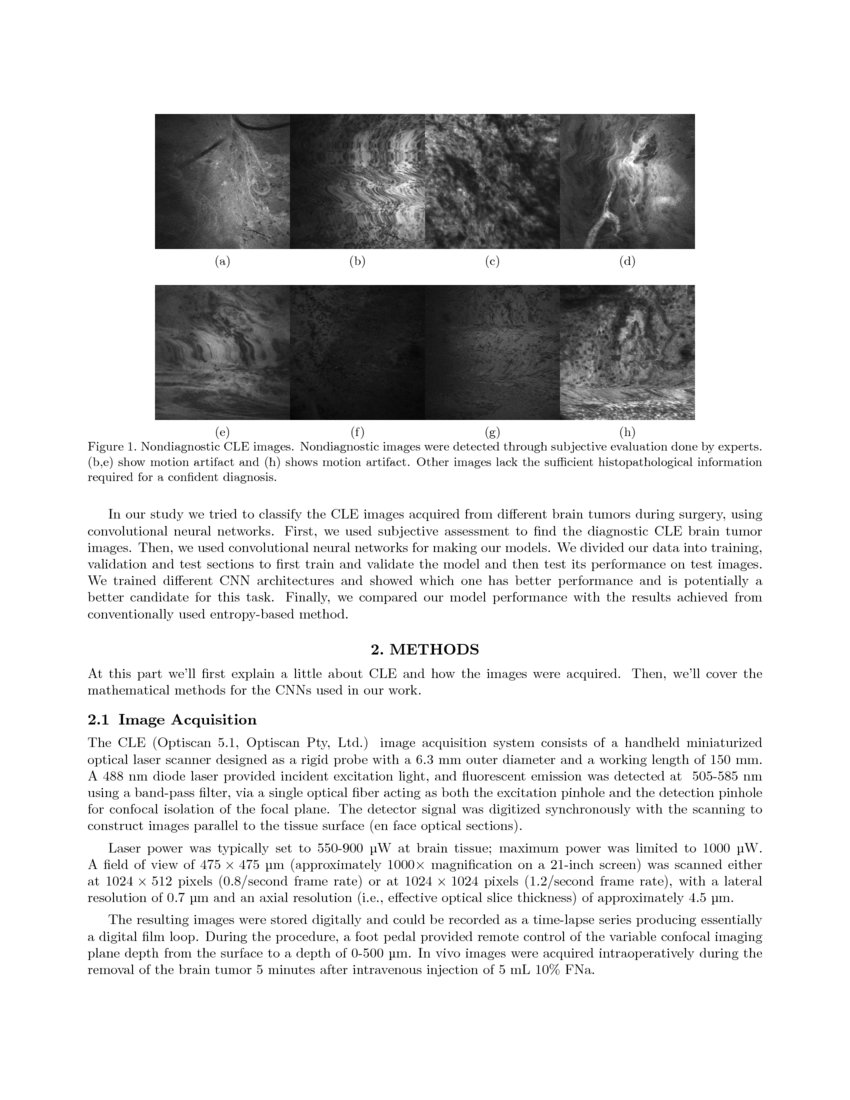 Improving utility of brain tumor confocal laser endomicroscopy ...