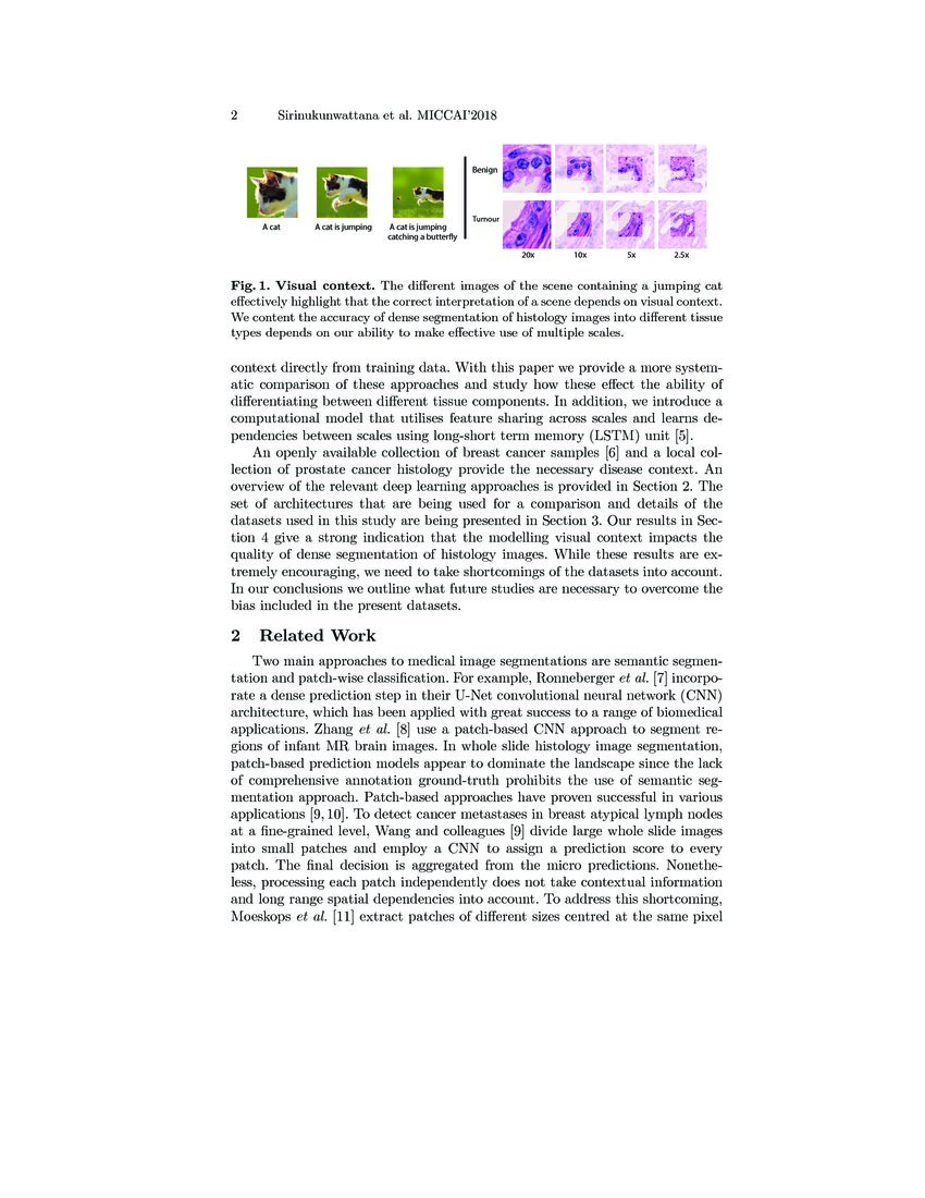 Improving Whole Slide Segmentation Through Visual Context - A Systematic Study | DeepAI