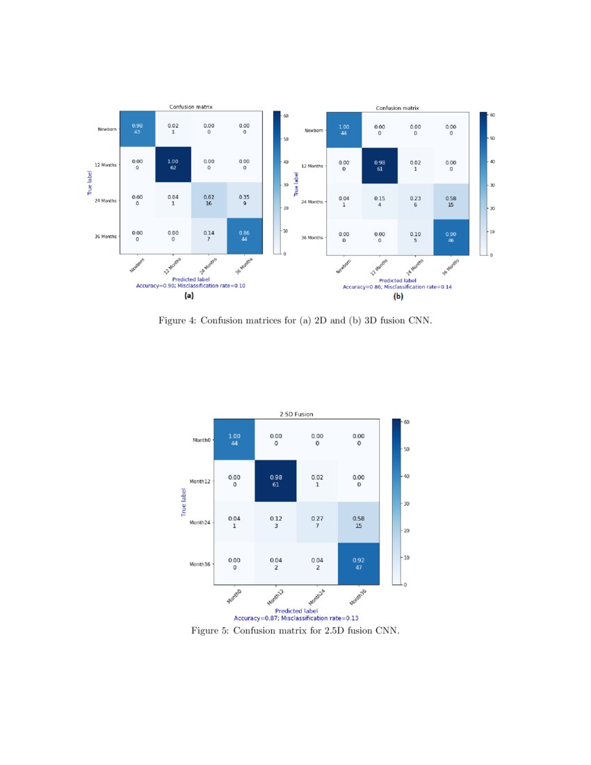 Infant Brain Age Classification: 2D CNN Outperforms 3D CNN in Small ... Infant Brain Age Classification: 2D CNN Outperforms 3D CNN in Small ...