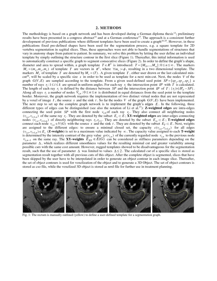 Interactive and Scale Invariant Segmentation of the Rectum/Sigmoid via ...