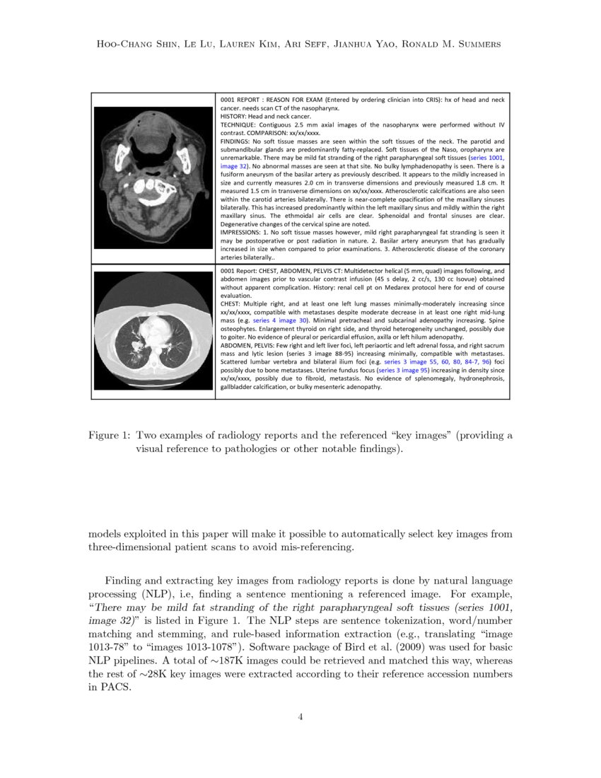 Interleaved Textimage Deep Mining On A Large Scale Radiology Database For Automated Image