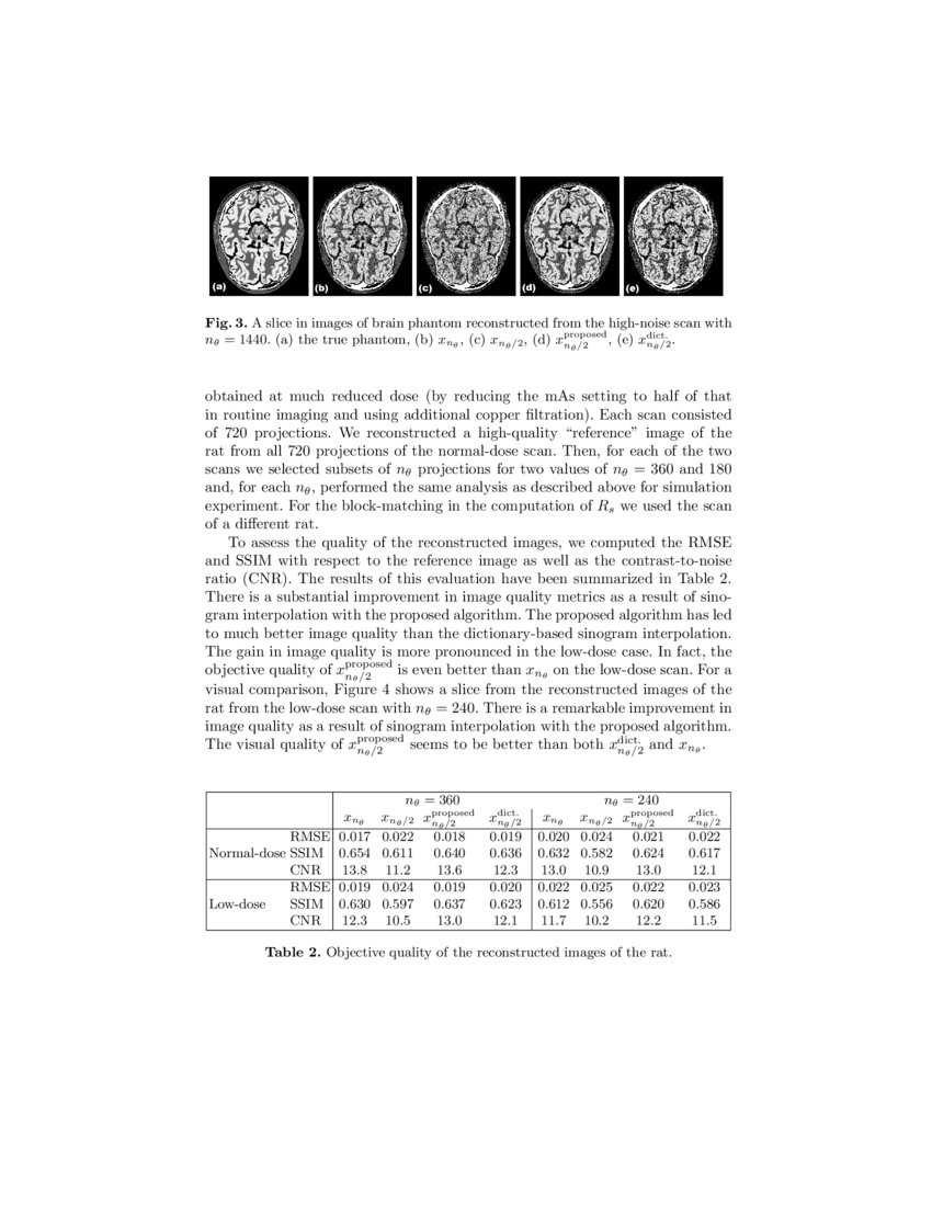 Interpolation of CT Projections by Exploiting Their Self-Similarity and ...