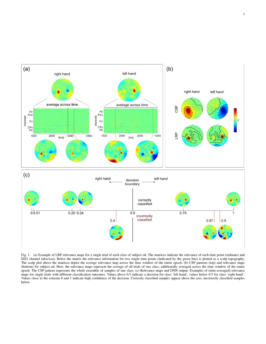 Interpretable Deep Neural Networks for Single-Trial EEG Classification | DeepAI
