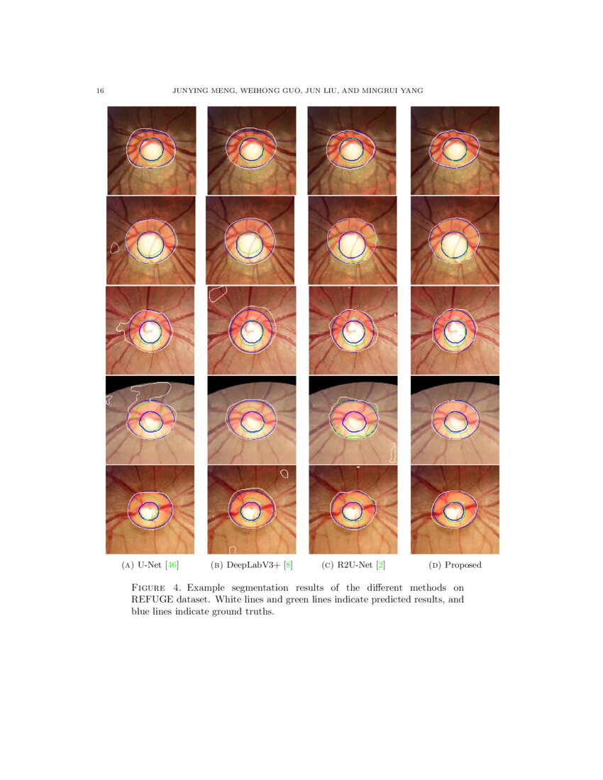 Interpretable Small Training Set Image Segmentation Network Originated
