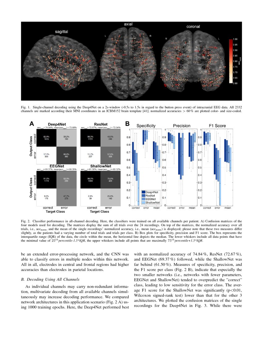 Intracranial Error Detection via Deep Learning | DeepAI