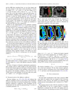 Investigating molecular transport in the human brain from MRI with physics-informed neural ...