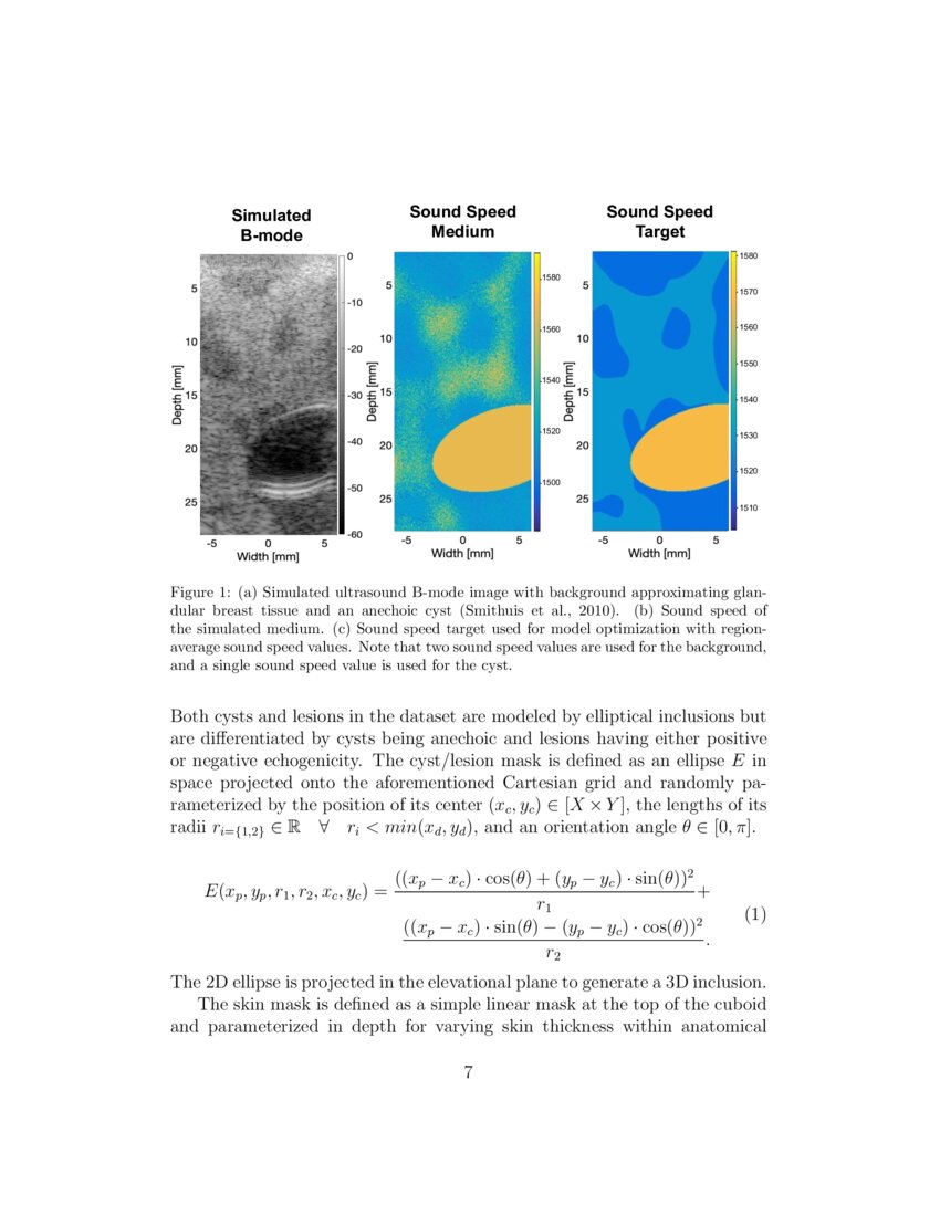 Investigating Pulse Echo Sound Speed Estimation In Breast Ultrasound