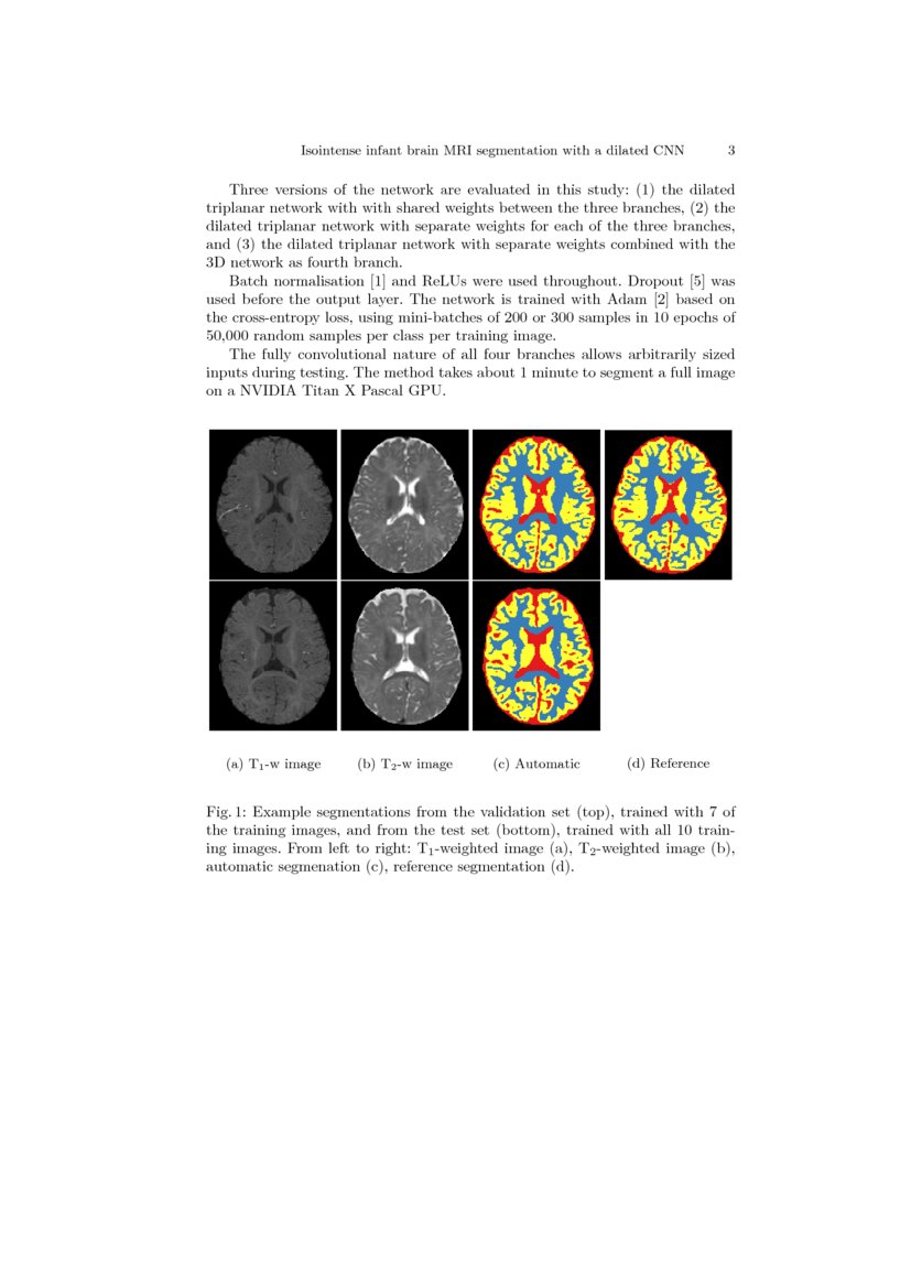 Isointense infant brain MRI segmentation with a dilated convolutional neural network | DeepAI