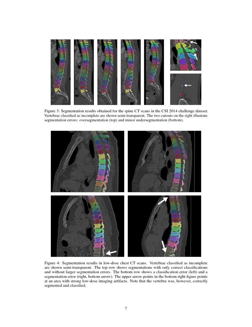 Iterative Fully Convolutional Neural Networks For Automatic Vertebra Segmentation Deepai