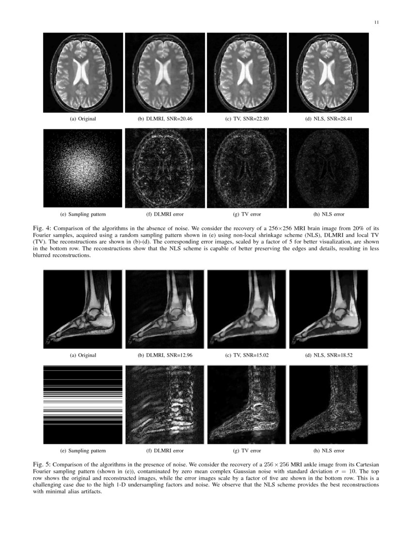 Iterative Non Local Shrinkage Algorithm For Mr Image Reconstruction Deepai
