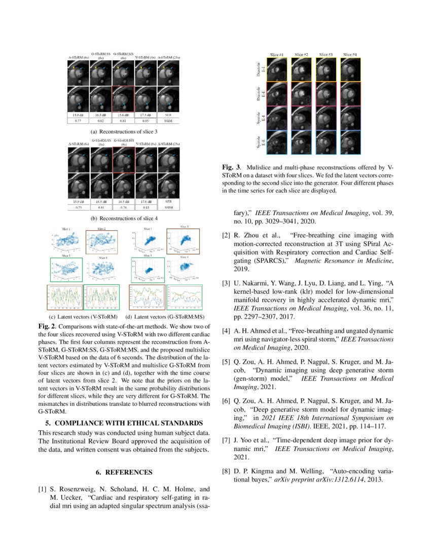 Joint alignment and reconstruction of multislice dynamic MRI using variational manifold learning ...