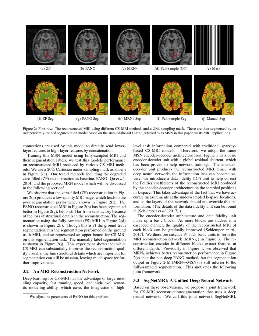 Joint CS-MRI Reconstruction and Segmentation with a Unified Deep ...
